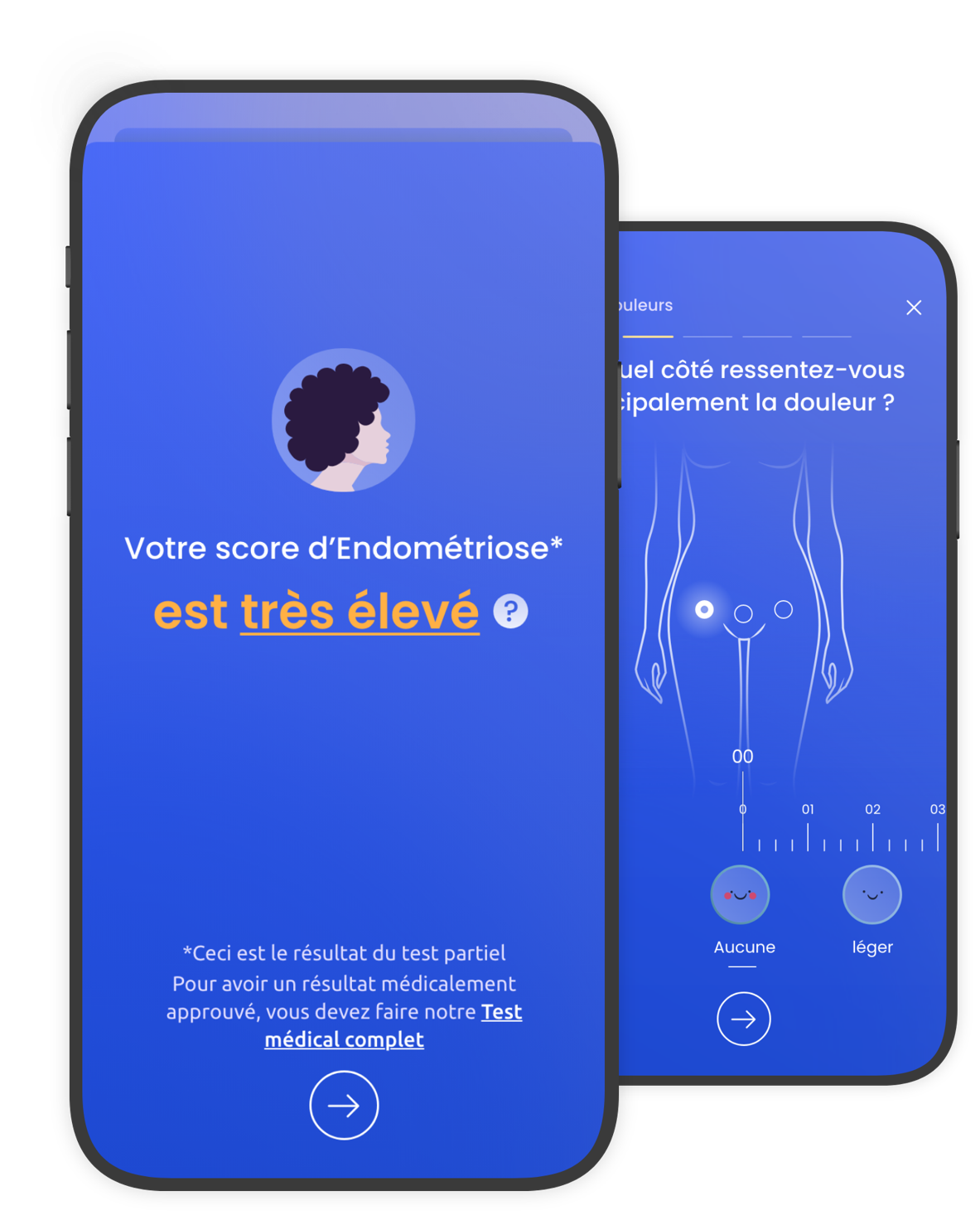 Luna, une app pour réduire le délai de diagnostic de l’endométriose